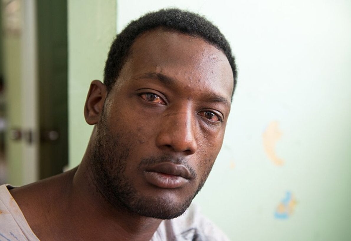 CHIKUNGUNYA: the virus that "bends up" - PAHO/WHO | Pan American Health ...